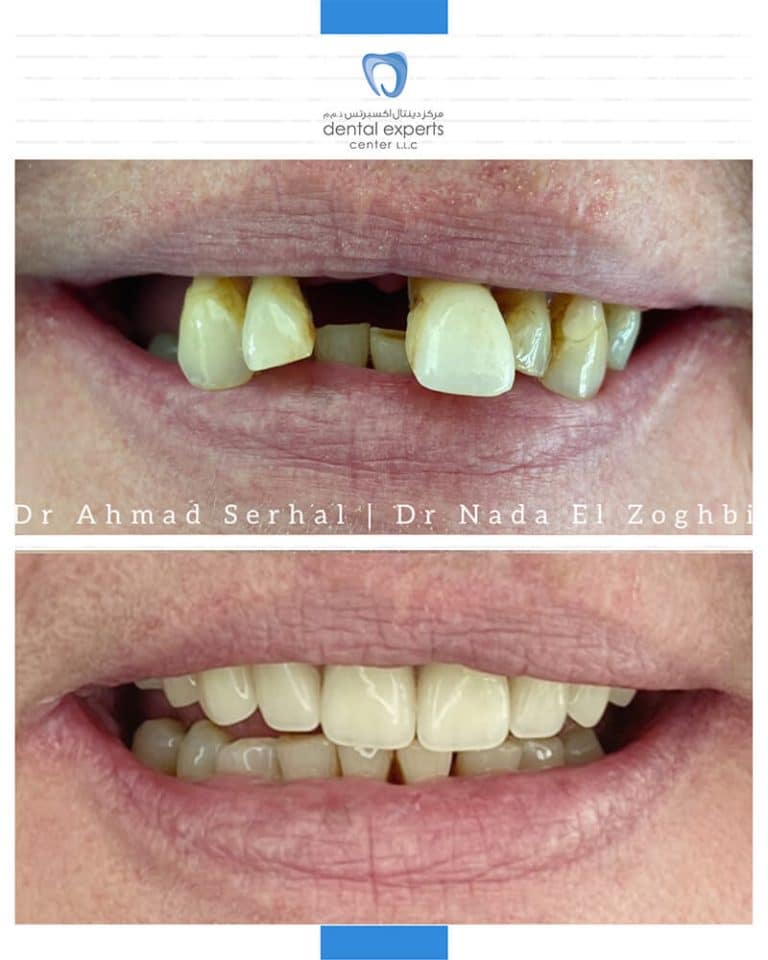 Dental Gallery | Dental Experts Center